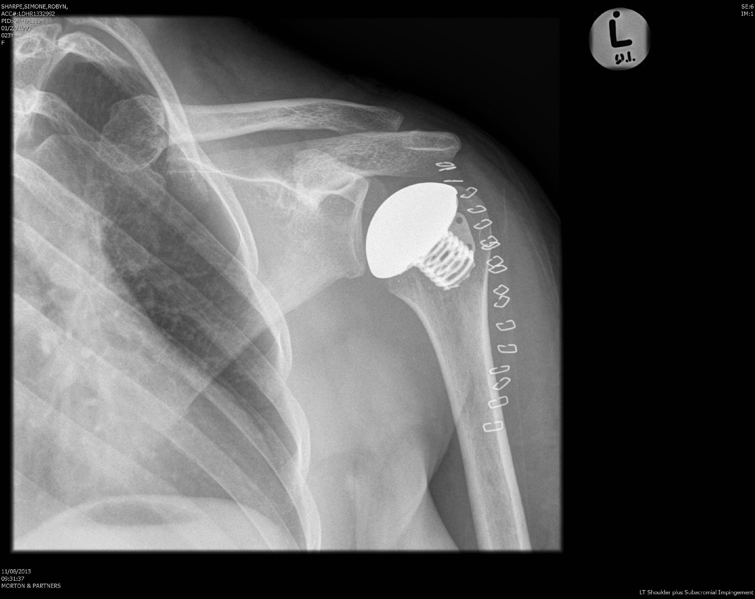 Epic Insights: She UNTAMED - 2024 Absa Cape Epic Chapter 3